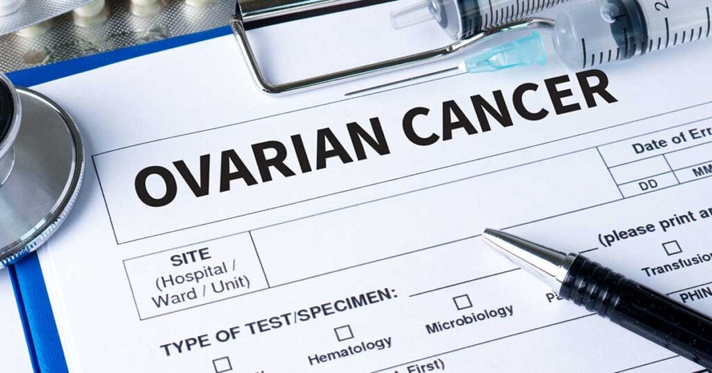 Ovarian Cancer Risk Factors And Prevention Health365 Sg